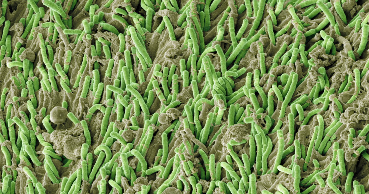 Fusobacterium nucleatum : une bactérie du microbiote oral qui favorise le développement des ...